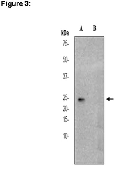 RIPAb+™ Phospho-eIF4E (Ser209) - RIP Validated Antibody and Primer Set ...